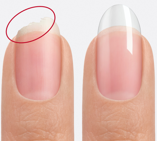 What is so special about CND PLEXIGEL™?