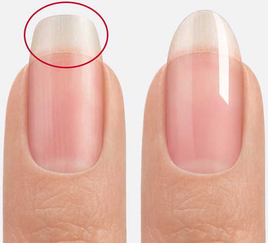 What is so special about CND PLEXIGEL™?