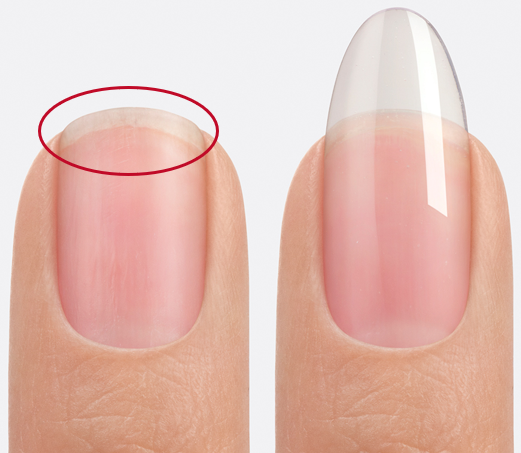 What is so special about CND PLEXIGEL™?