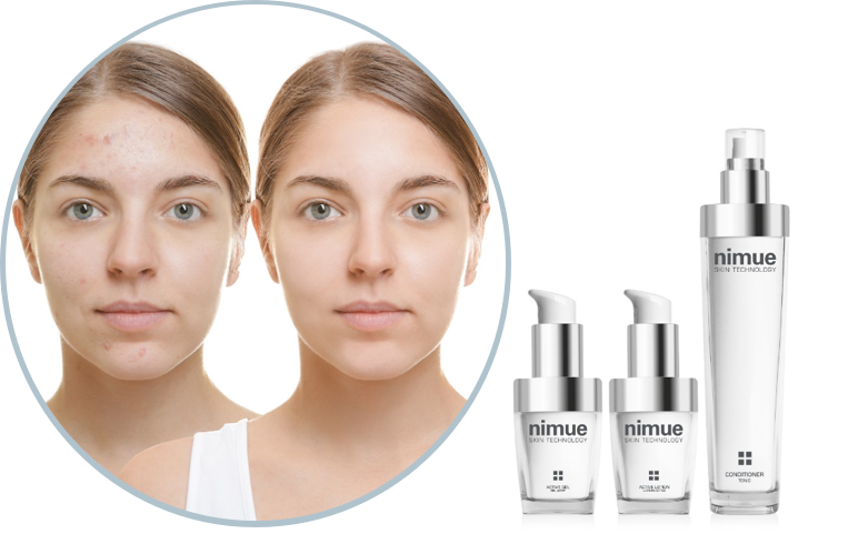 How do I use my nimue homecare starterkit?